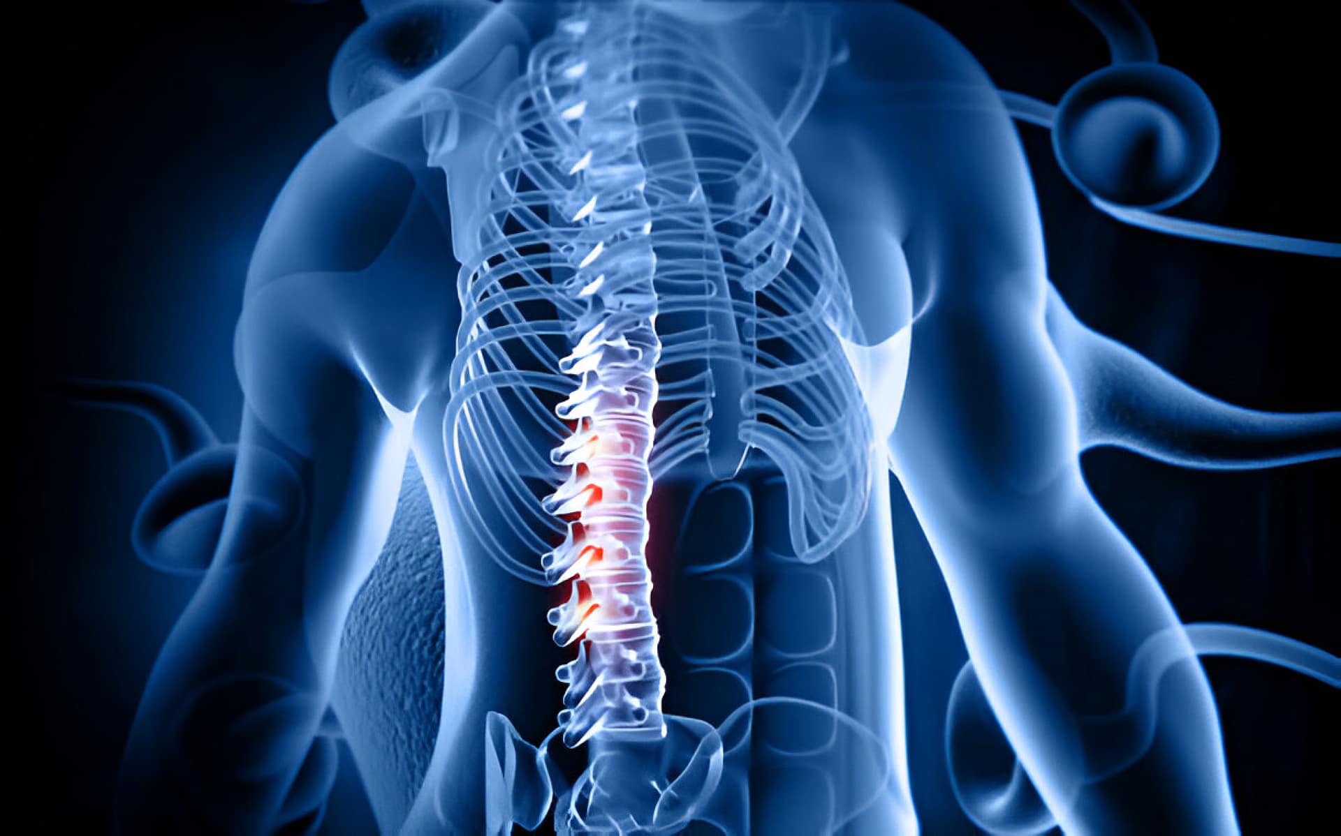 Chiropractic Care For Bulging Discs And Benefits Over Surgery